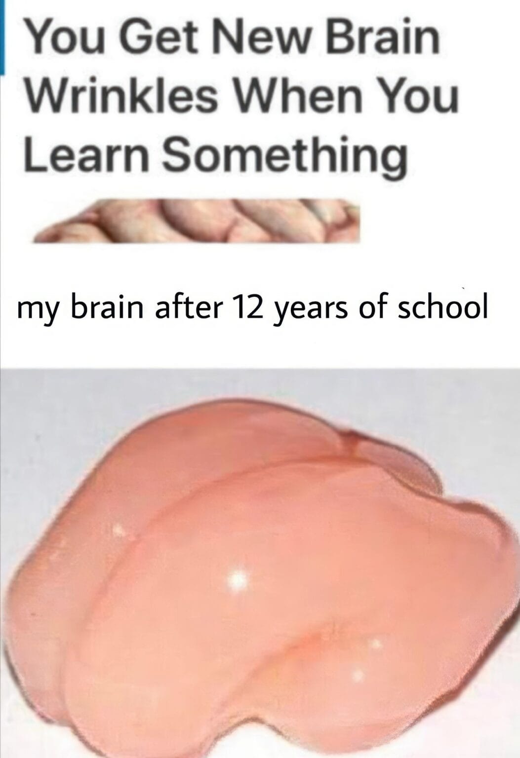 The Best Smooth Brain Jokes To Brighten Your Day